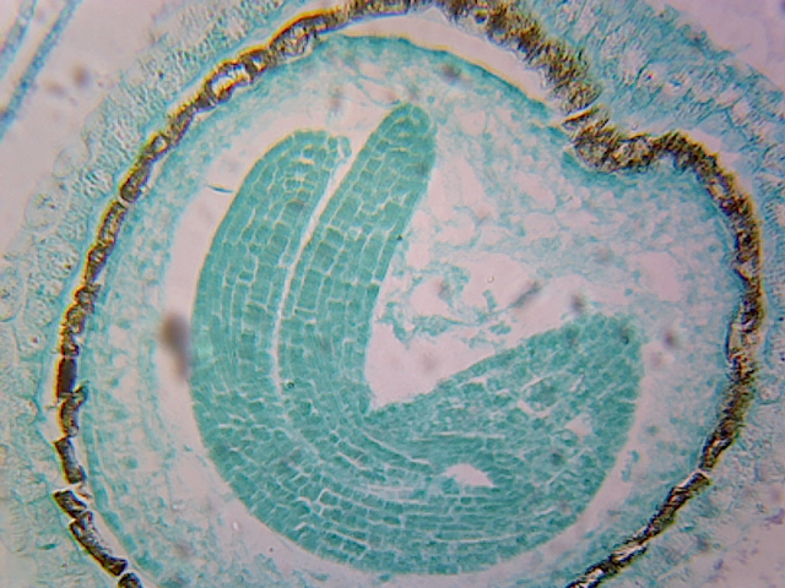 Capsella Embryo, Later Cotyledon Stage; Longitudinal Section