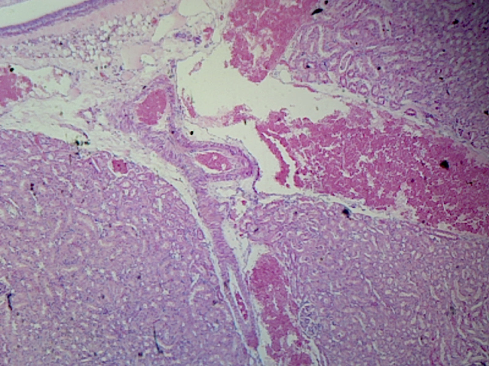 Kidney, Mammalian; Longitudinal Section; Showing Renal Pelvis, Calyces